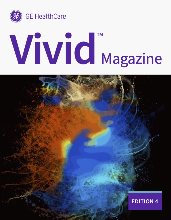 GE Vivid Club - Vivid Magazine